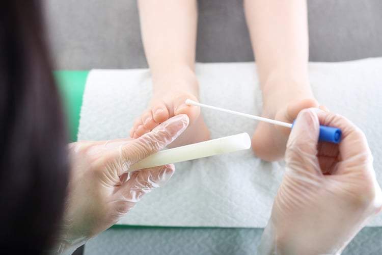 Stop Toenail Pain From Bacterial Toenail Infection