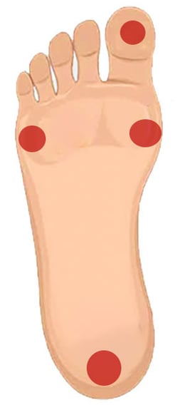 Diabetic Foot Ulcers, ARE YOU At Risk?