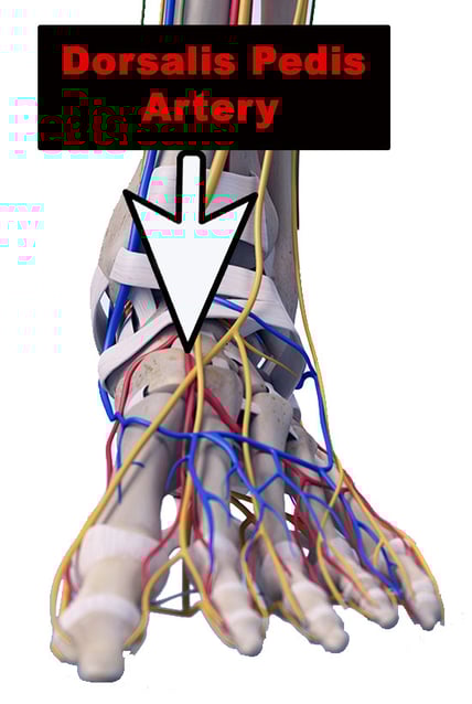 Diabetic Foot Ulcers, ARE YOU At Risk?